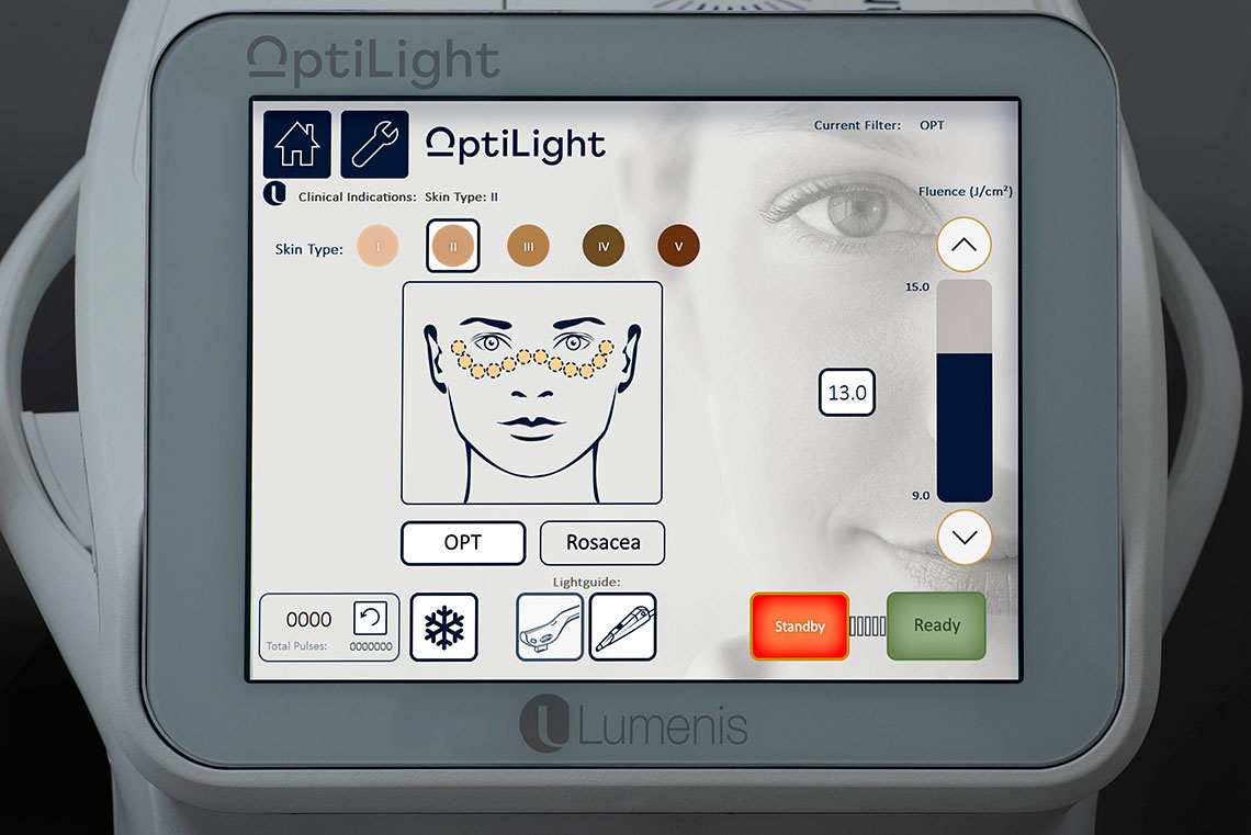 Optilight IPL Dry Eye Treatment | Neil Modi